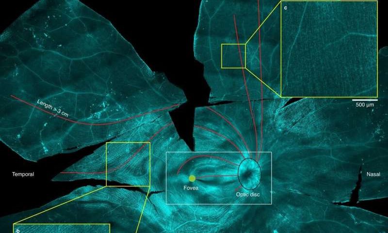 New insights into how the visual system synchronizes visual information ...